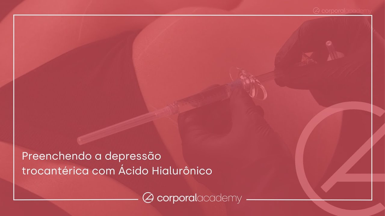 Preenchendo a depressão trocantérica com Ácido Hialurônico | Corporal Class