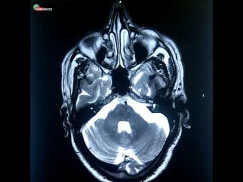 What is Your diagnose?