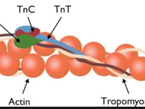 Only Troponin