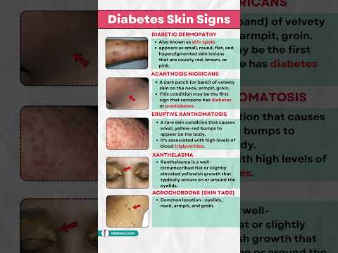 Diabetes Warning Signs: 5 Skin Changes That Could Save Your Life 🔴 #diabetes #ytshorts #nutrition