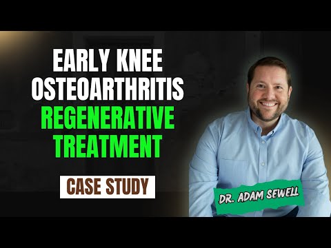 Case Study: Early Knee Osteoarthritis Regenerative Treatment | Dr. Adam Sewell, MD