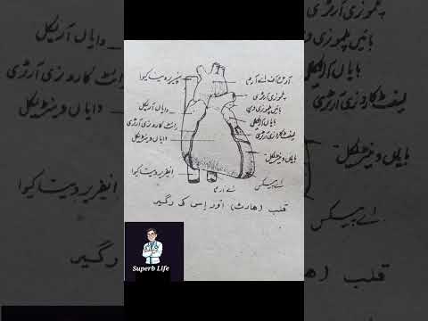 Another name for death is heart attack #medical #viral #video