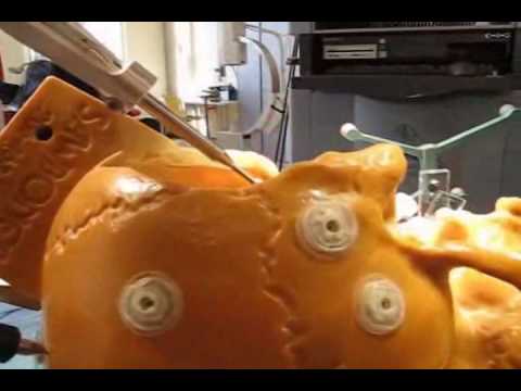 4 skullbase_wind.wmv