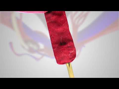 How to do the Boari flap procedure, step by step