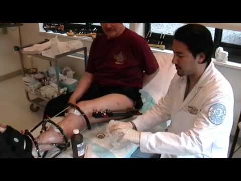 Pin Care - Monolateral Frame