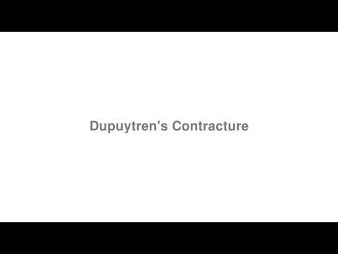 How to Pronounce "Dupuytren's Contracture"