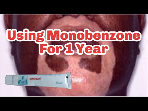 Pharmaceutical Injection and Pharmaceutical Tablet Manufacturer ...