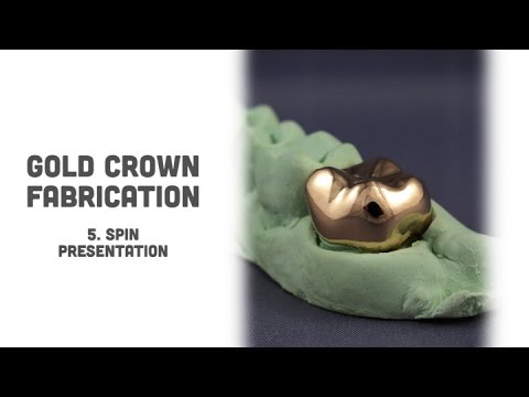 Gold Crown Fabrication: 05. Spin Presentation