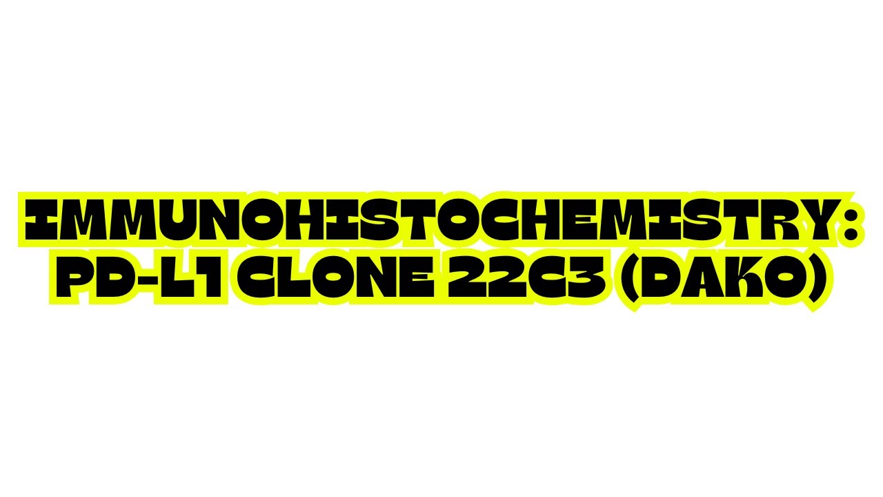 IMMUNOHISTOCHEMISTRY: PD-L1 CLONE 22C3 (DAKO)