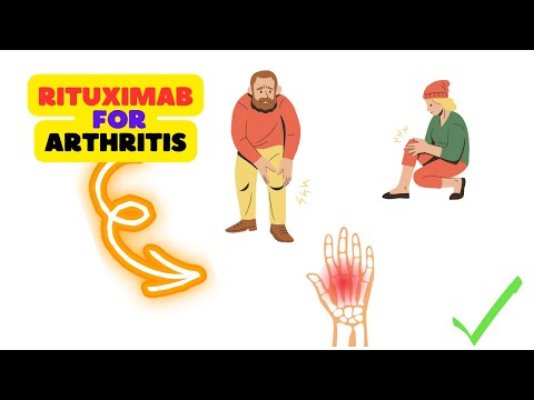 Decoding Rituximab Side Effects: A Guide to Managing Your Treatment Journey