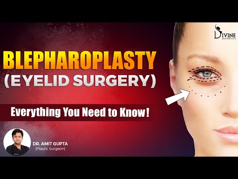 Blepharoplasty (Eyelid Surgery) – Everything You Need to Know! Dr Amit Gupta