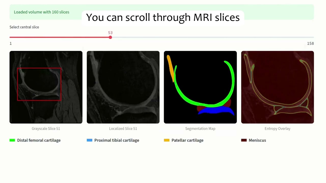 KneeXNet-2.5D: An Explainable AI for 2.5D Knee MRI Segmentation