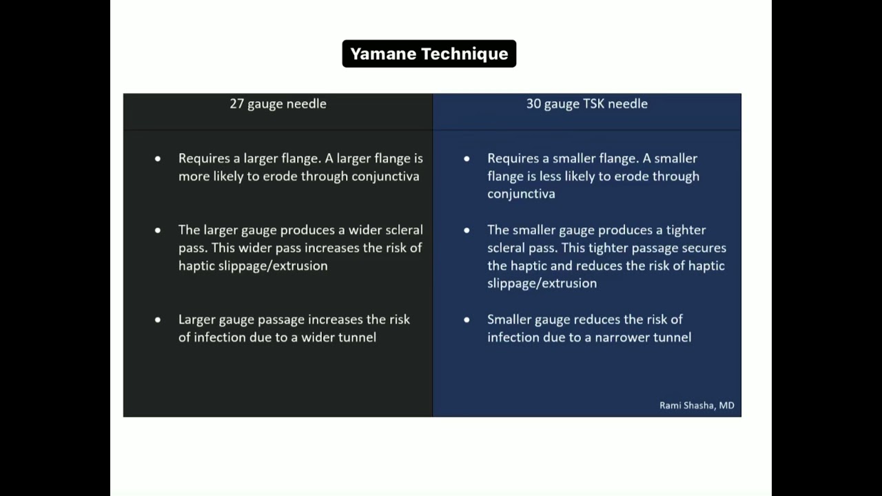 Yamane Technique - 30 g TSK vs 27 g needle