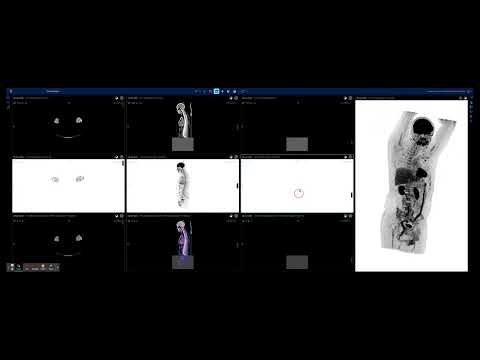 GaelO PET/CT