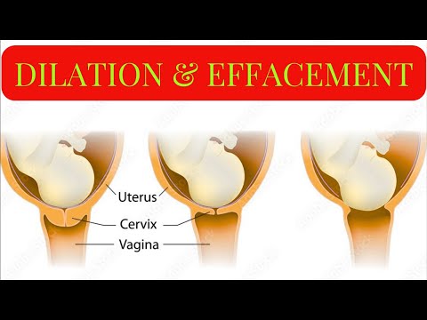 “0 to 10 cm: What Dilation & Effacement Mean for Labor”