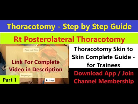 How to do Open Thoracotomy Part 1 (Theory) – Right Posterolateral. A Complete Guide For Beginners.