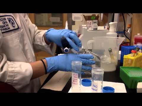ALfA Blood Processing
