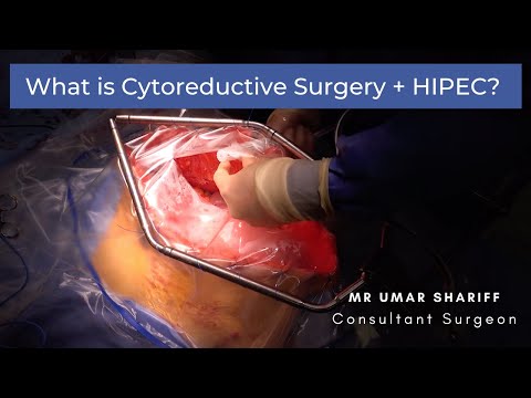 Cytoreductive Surgery + HIPEC: What is it?
