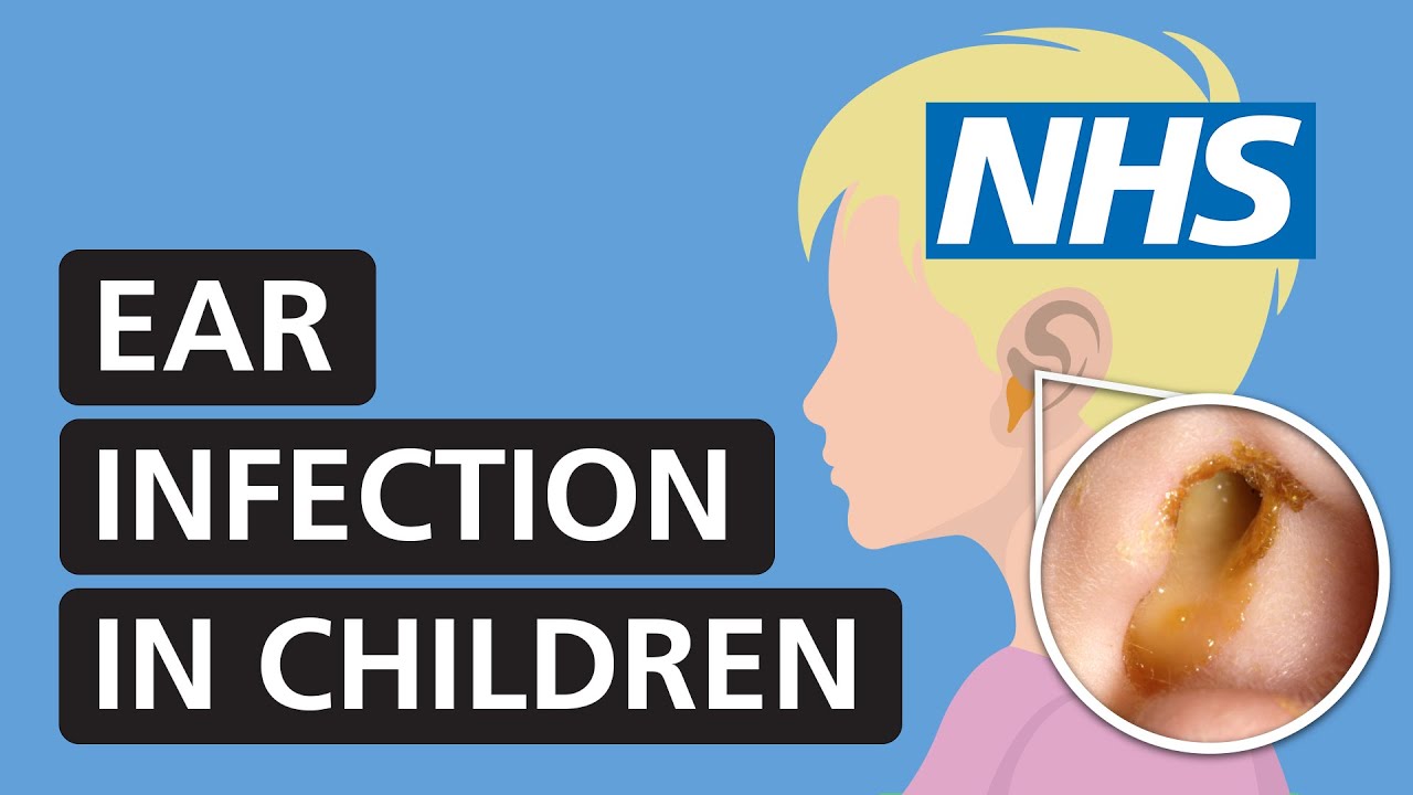 Ear infection in children: symptoms and treatment | NHS
