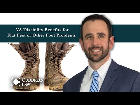 VA Disability Benefits for Flat Feet or Other Foot Problems?