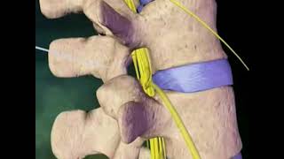 Spinal Injection Pain Management Treatment- IBS Hospital