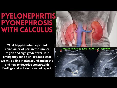 Kidneys ultrasound | kidney stones | urinary tract infection | pyelonephritis ultrasound | renal usg