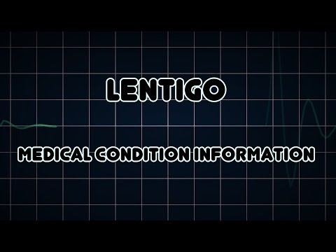 Lentigo (Medical Condition)