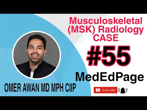 Musculoskeletal (MSK) Radiology CASE #55