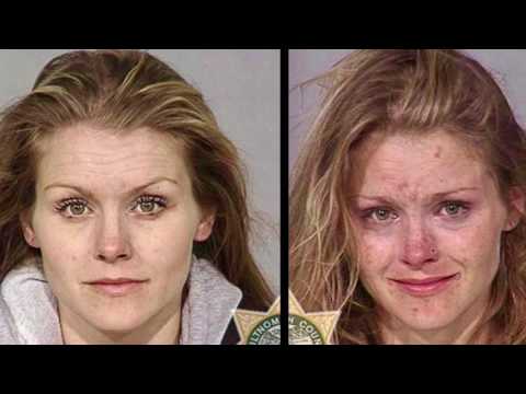 Faces Of Meth-Before And After