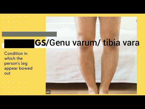 Postural Defects II