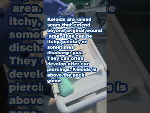 Watch this Keloid Removal Video!