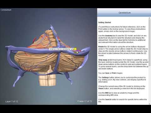 Anterior inferior cerebellar artery | Arteries of head and neck | 3D Human Anatomy | Organs