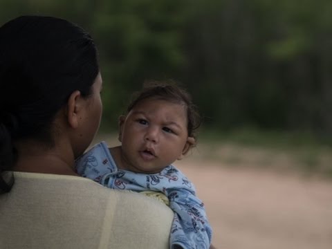CDC: Zika Definitely Causes Severe Birth Defects