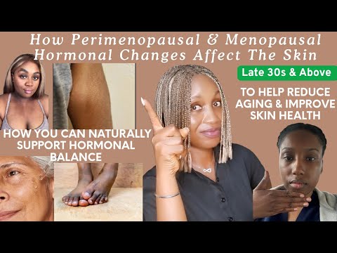 How Perimenopausal &Menopausal Hormonal Changes Affect The Skin, Natural Way To Balance It