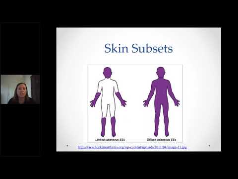 Predicting Progression in Scleroderma, Laura Hummers, M.D.,Sc.M.