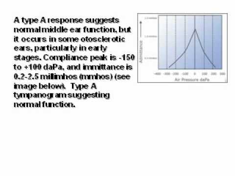 Tympanometry.flv