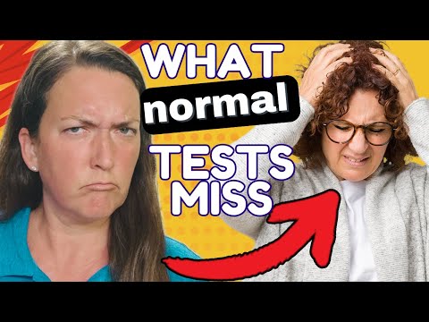 BPPV with a Normal VNG test is Difficult to Catch Here's Why | The Vertigo Detective