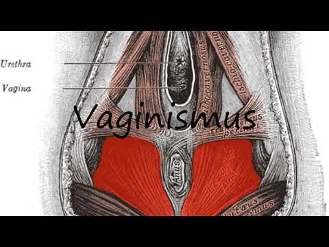 How to Pronounce Vaginismus?
