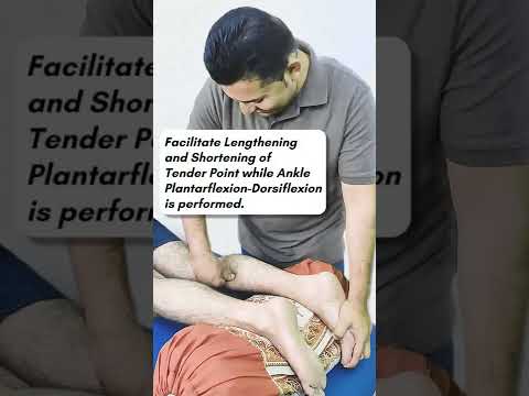 CALF PAIN TREATMENT BY FUNCTIONAL RELEASE TECHNIQUE.