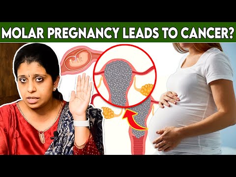 Fallopian Tube-ஐ Remove பண்ணா Pregnant ஆகா முடியுமா? - Dr.Deepthi Jammi | Pregnancy Tips