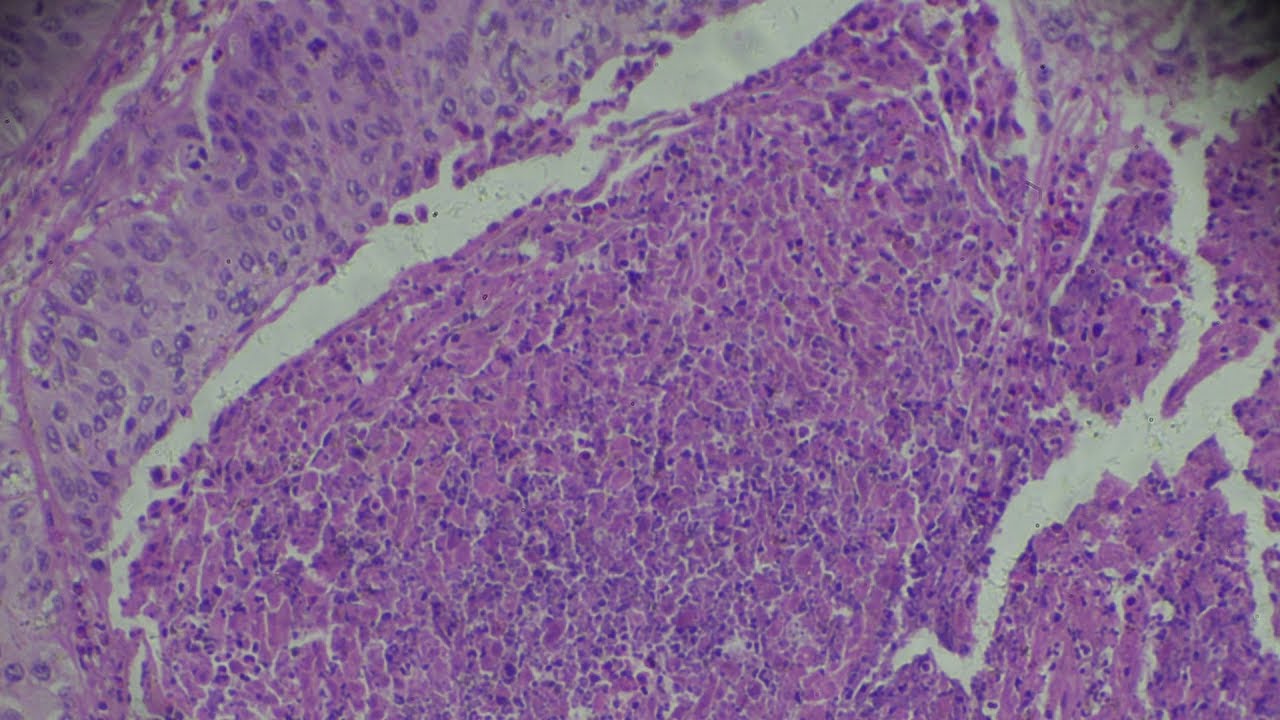 Single-Molecule Method Reveals Functional Inheritance of EGFRs in Extracellular Vesicles