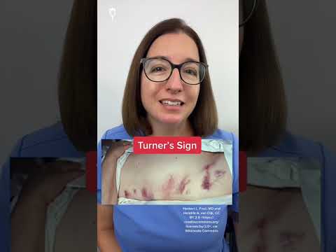 Turner's Sign: Medical-Surgical SHORT | @LevelUpRN