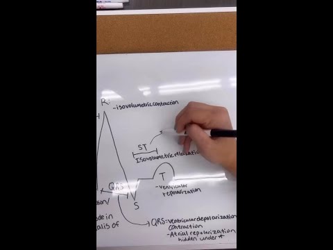 Understanding EKG Waves