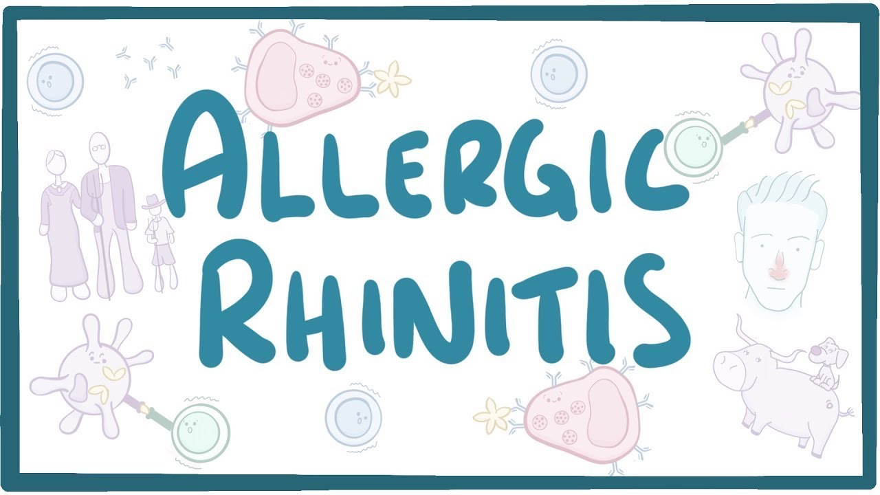 Allergic Rhinitis - causes, symptoms, diagnosis, treatment, pathology