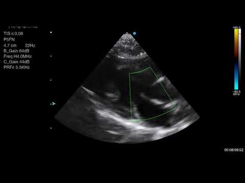 Colour Doppler on the right parasternal view in a feline