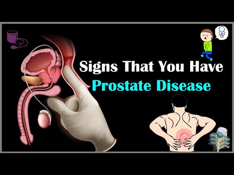 Signs That You Have Prostate Disease |Warning Signs Of Prostate Disease (Cancer?)