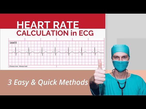 3 Easy Methods to Calculate Heart Rate on ECG - Quick & Simple