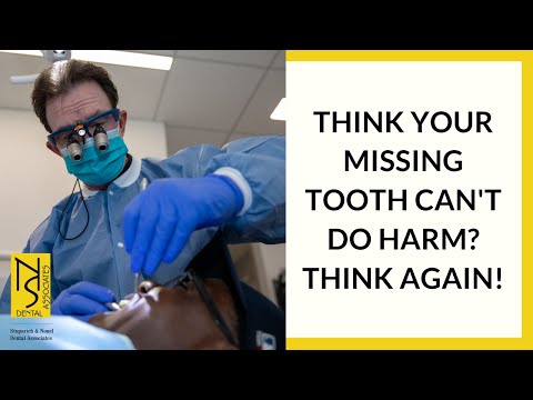 Think Your Missing Tooth Can't Do Harm? Think Again!