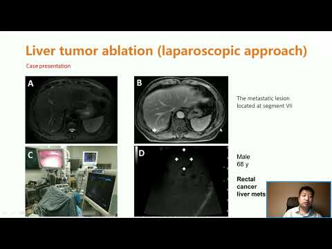 CCMA Webinar Lecture by Dr. Zhe Tang