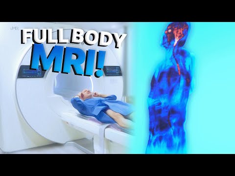 My Experience with the Full Body MRI Scan with Dr. Aras at AMRIC Health!